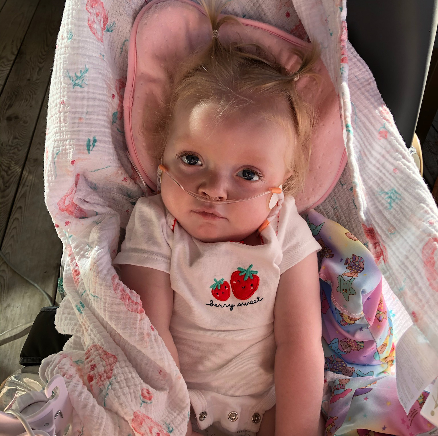 Vici Syndrome – RARE-X